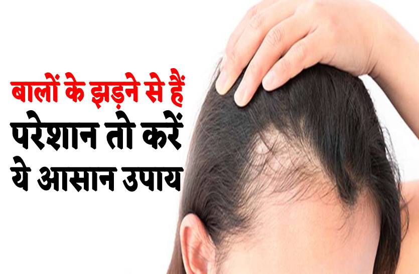 How To Stop Hair Fall Immediately At Home Simple Tips झड़ रहे हैं