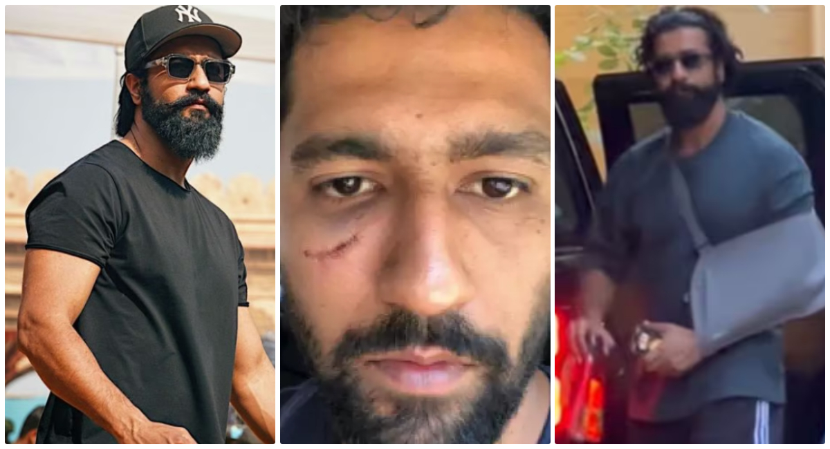 एक्शन सीन शूट करते हुए विक्की कौशल के साथ हादसा, चोटिल अवस्था में ... एक्शन सीन शूट करते हुए विक्की कौशल के साथ हादसा, चोटिल अवस्था में ...